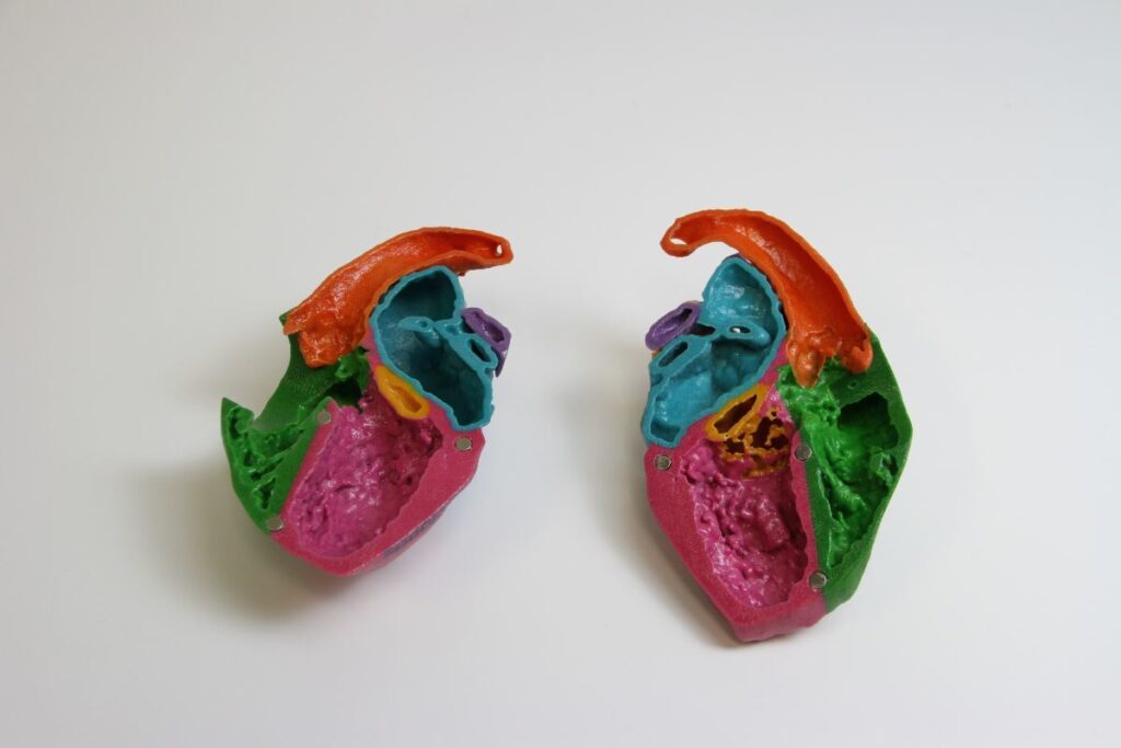 Medical Models Custom 3D Fabrication Services - WhiteClouds